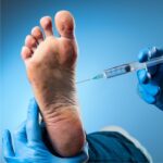 Understanding Plantar Fasciitis: Causes, Symptoms, and Solutions