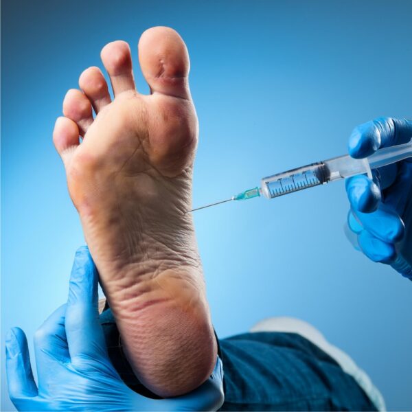 Understanding Plantar Fasciitis: Causes, Symptoms, and Solutions